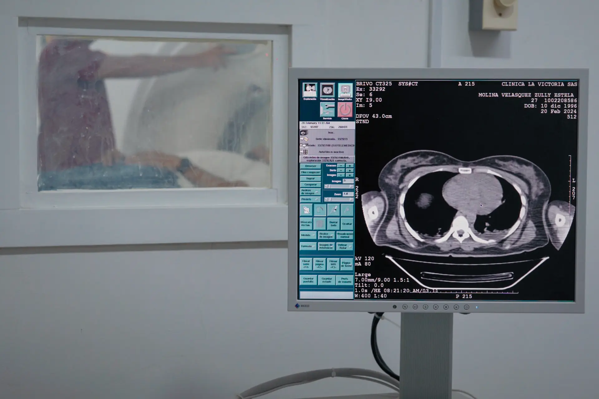 radiología e imágenes diagnosticas - Clinica la Victoria